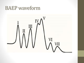 Brainstem auditory evoked response | PPTX