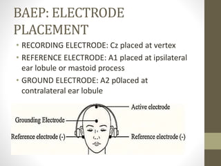 Brainstem auditory evoked response | PPTX