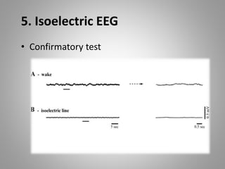 Brain stem death | PPTX