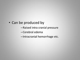 Brain stem death | PPTX