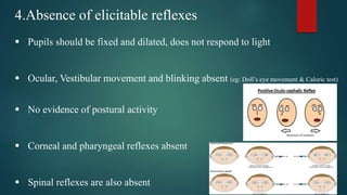 Brainstem Death And Its Medico Legal Perspectives | PPTX