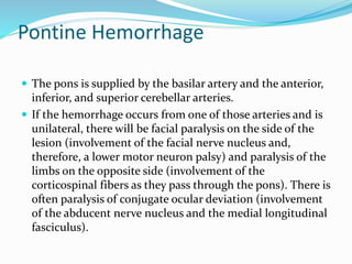Brainstem leisons | PPTX