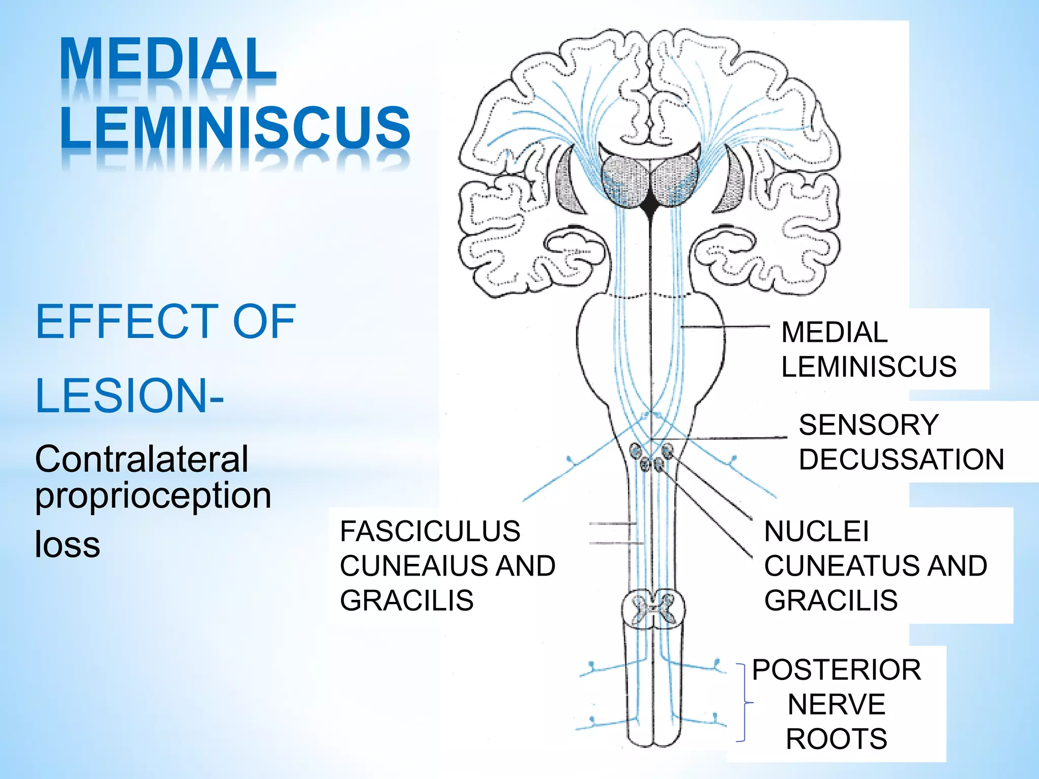 Brain stem Lesions | PPTX