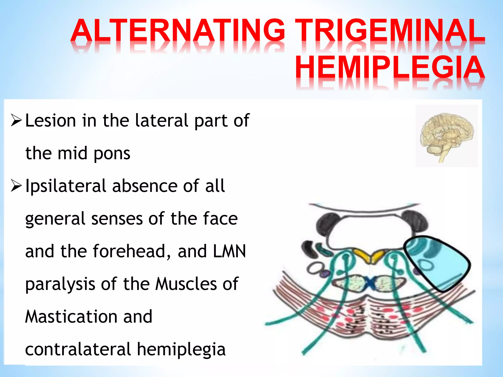 Brain stem Lesions | PPTX