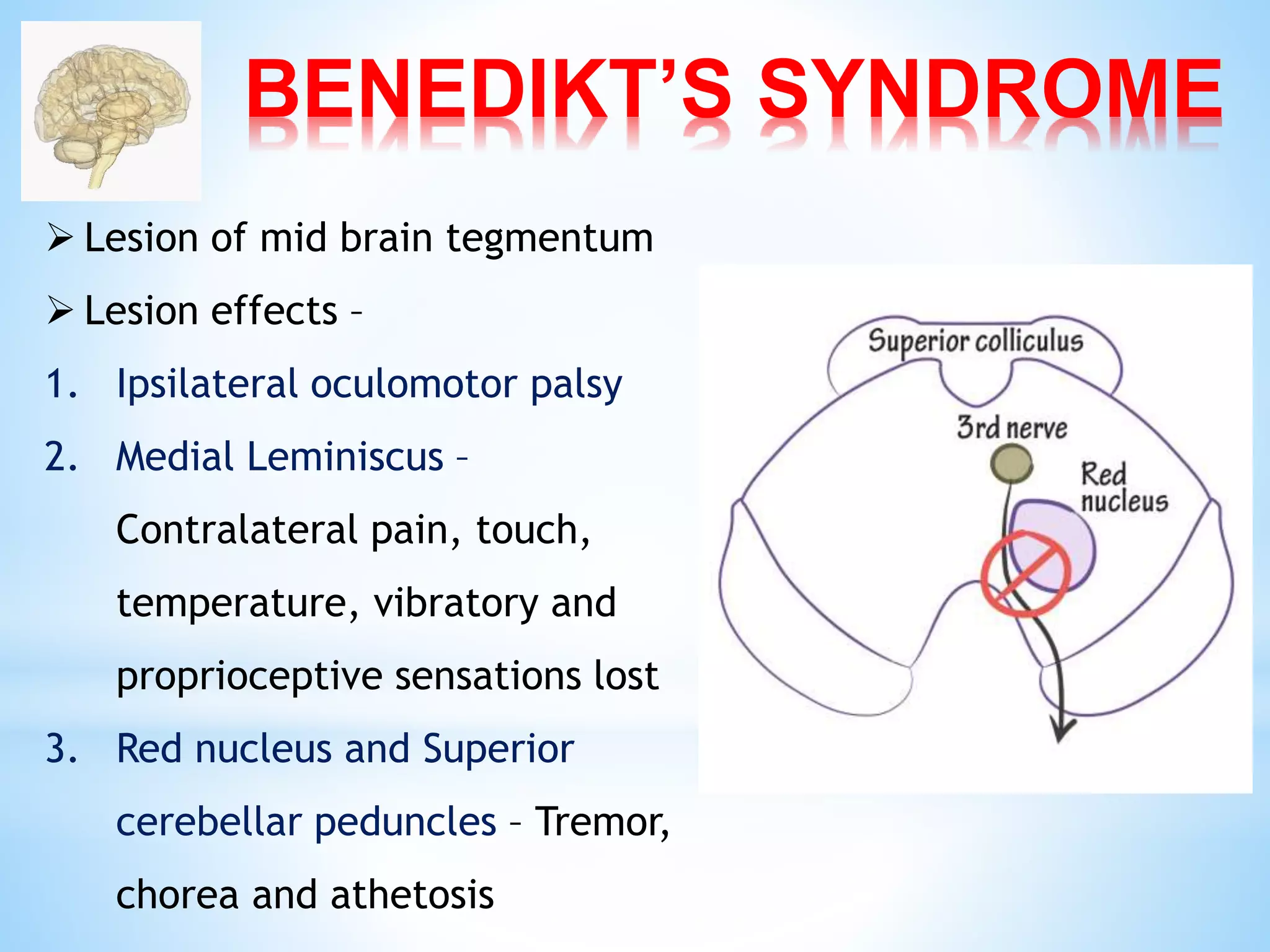 Brain stem Lesions | PPTX