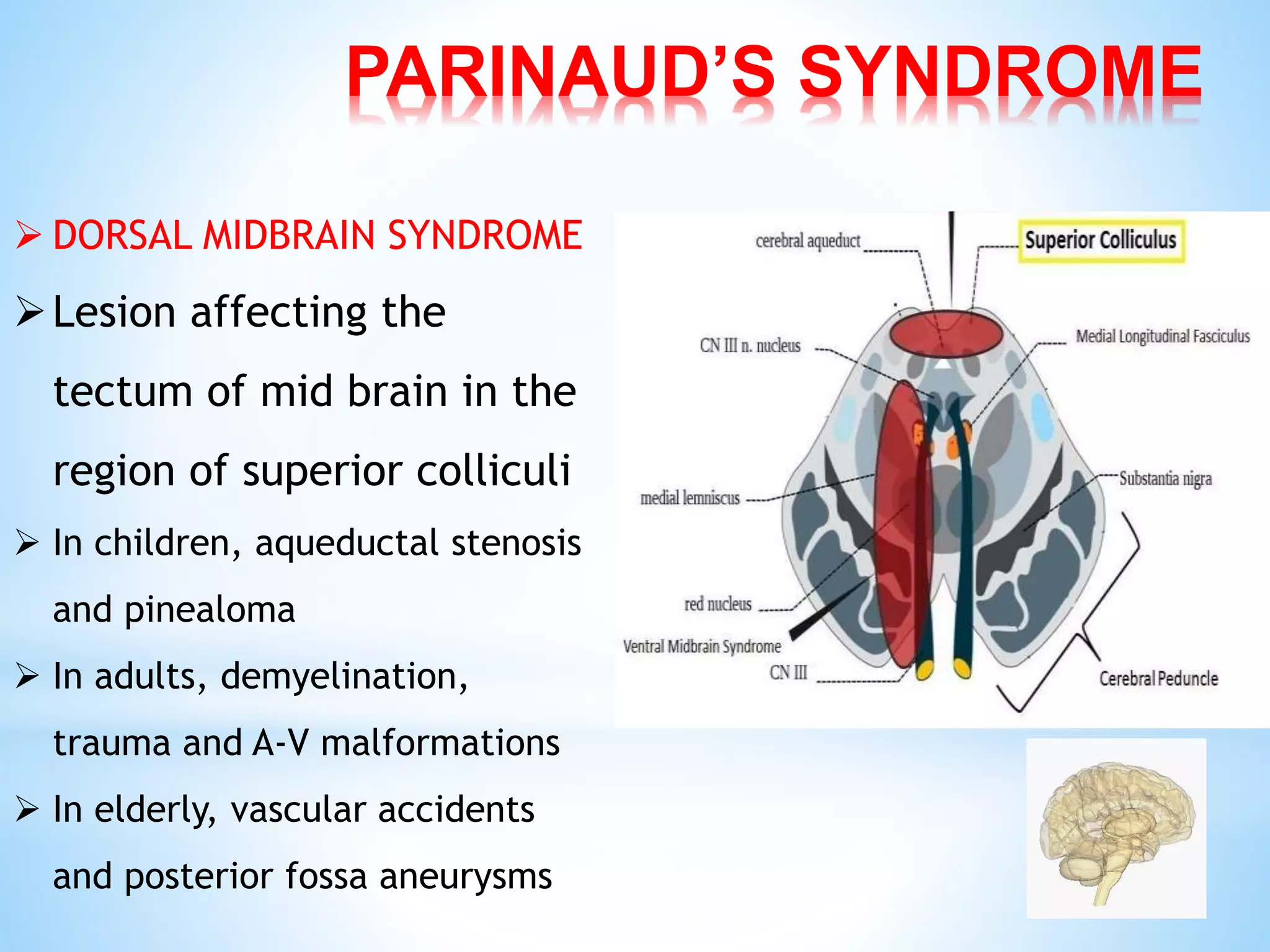 Brain stem Lesions | PPTX