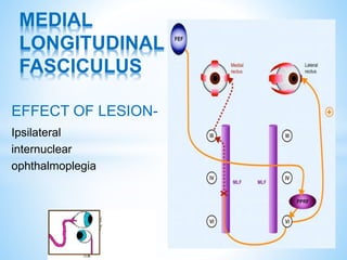 Brain stem Lesions | PPTX