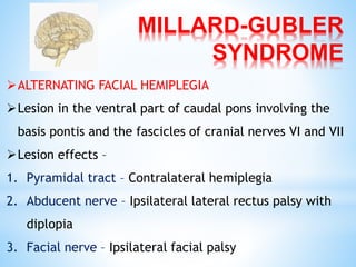 Brain stem Lesions | PPT