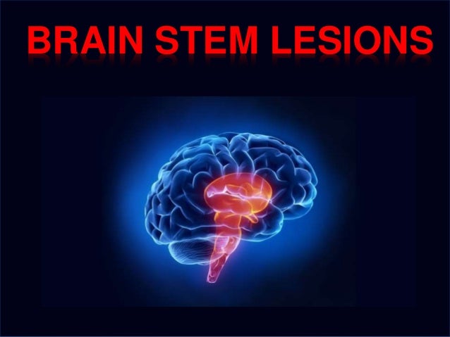 Brain stem Lesions