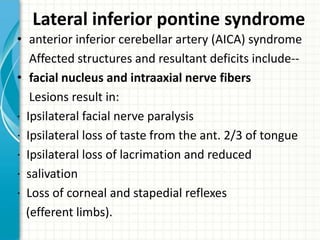 Brainstem stroke syndromes | PPTX