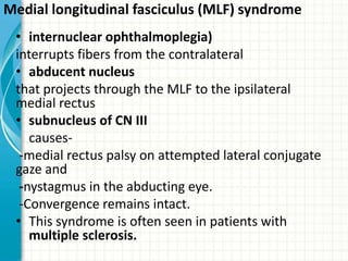 Brainstem stroke syndromes | PPTX