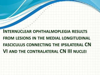 Brainstem stroke syndromes | PPTX