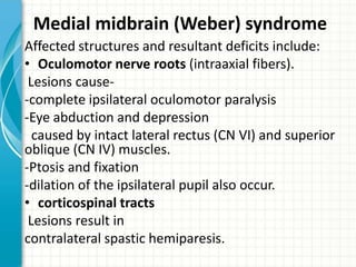 Brainstem stroke syndromes | PPTX