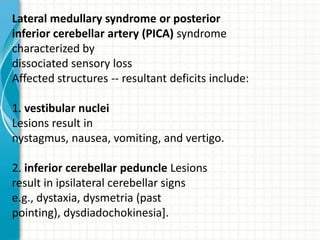 Medial Medullary Syndrome Usmle