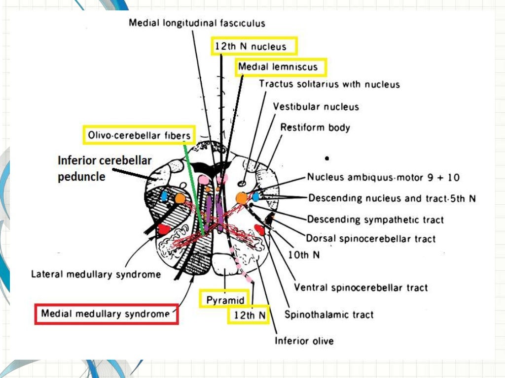 Brainstem Syndromes