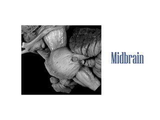 Brainstem stroke syndromes ppt | PPTX