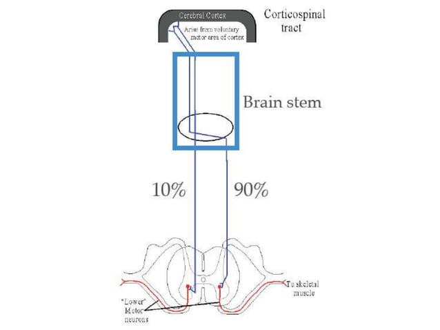 Brainstem stroke syndromes ppt | PPTX