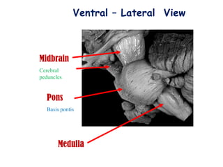Brainstem stroke syndromes ppt | PPTX