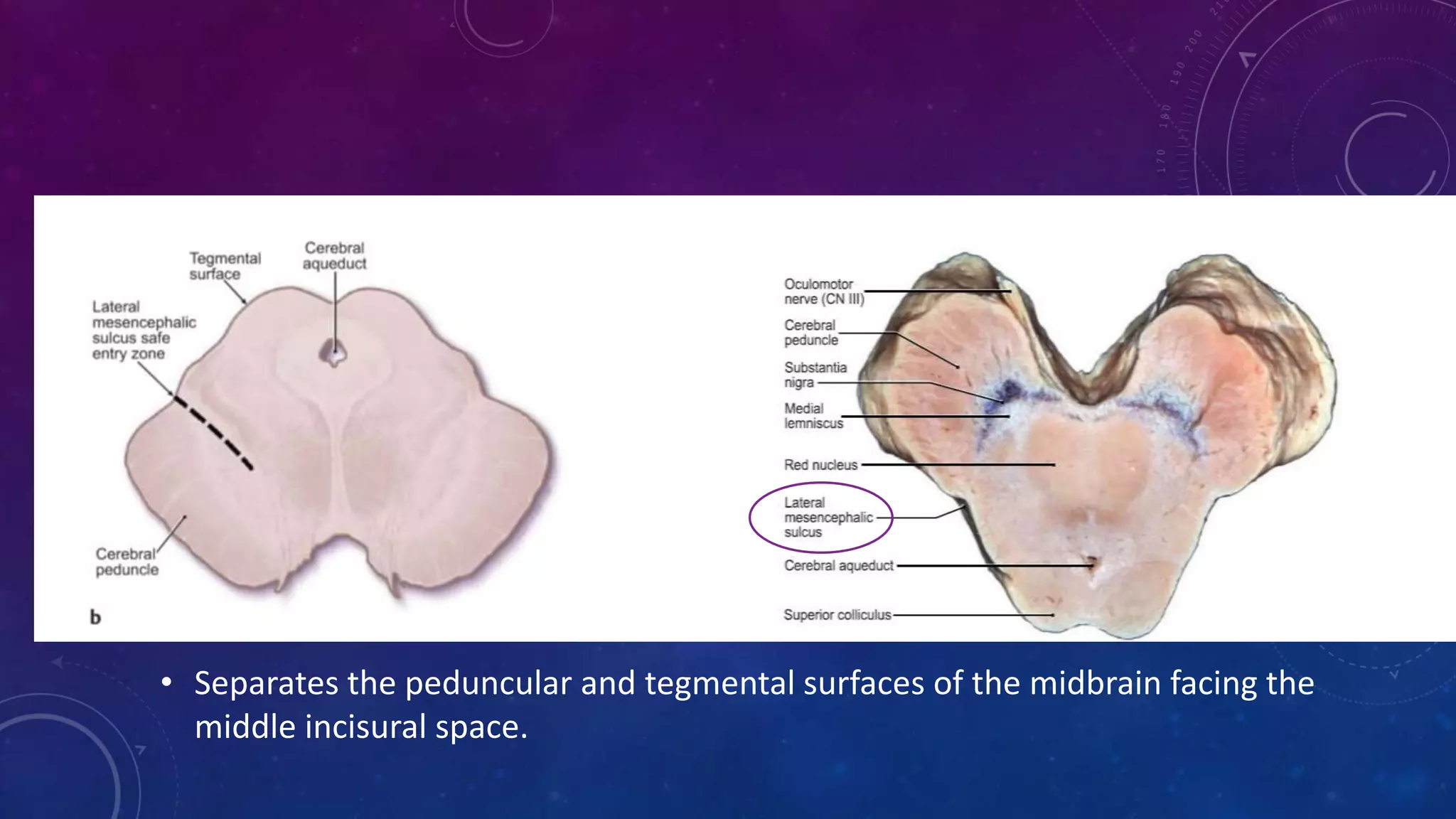 Brain stem surgical anatomy and approaches | PPTX