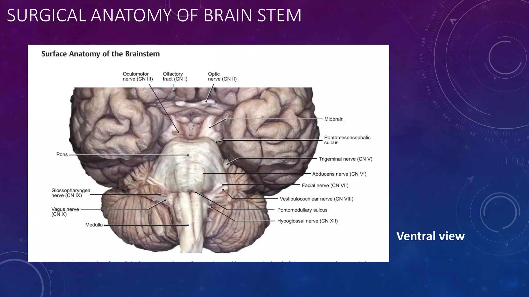 Brain stem surgical anatomy and approaches | PPTX