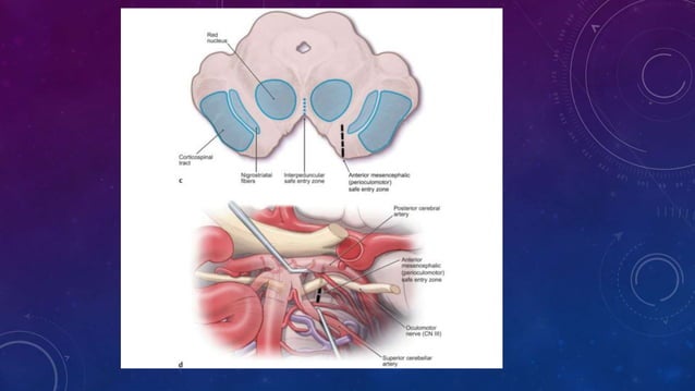 Brain stem surgical anatomy and approaches | PPTX | Death, Injury, or ...