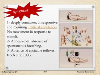 Brain stem syndrome | PPSX