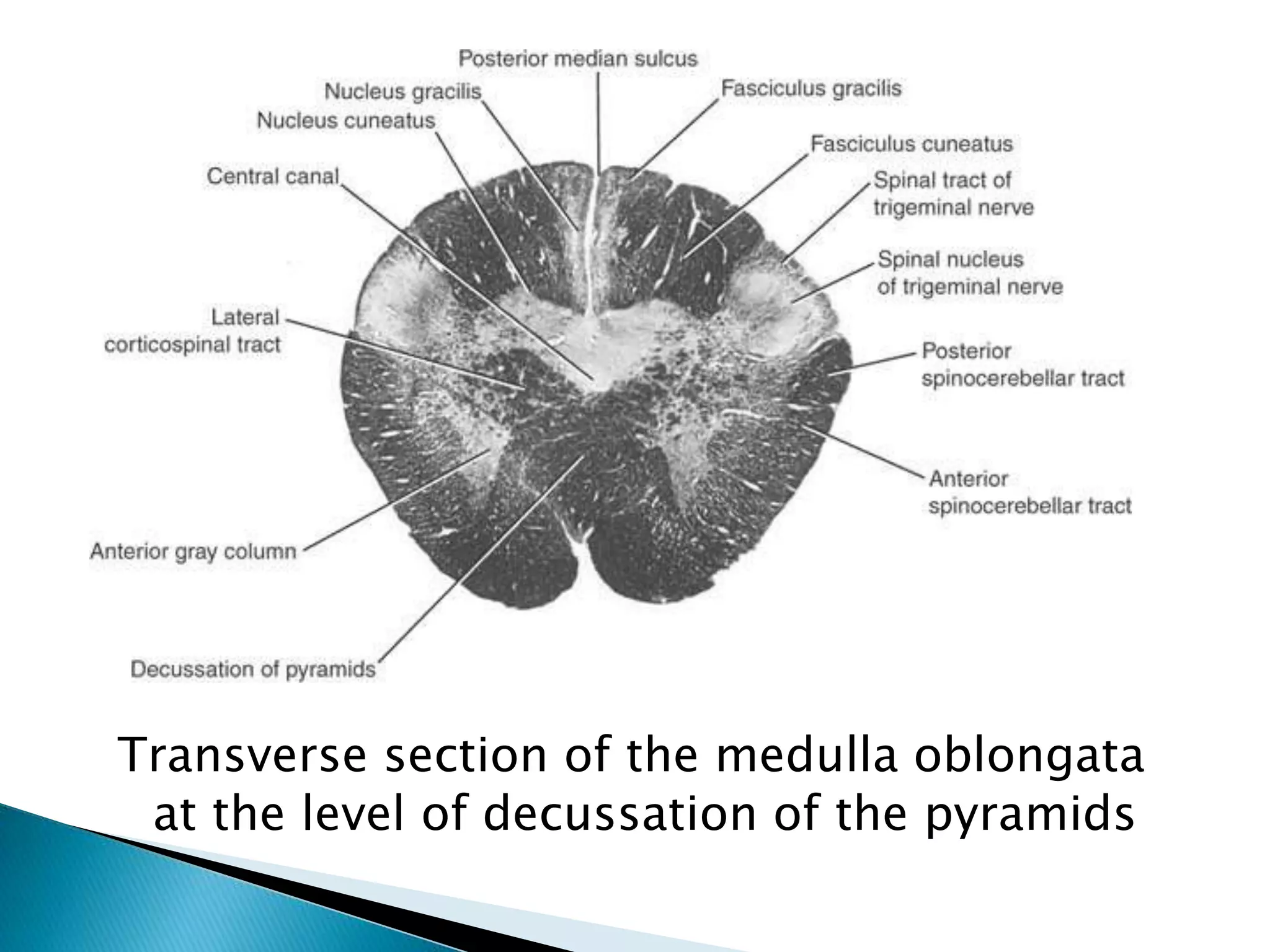 Brain stem syndromes | PPTX