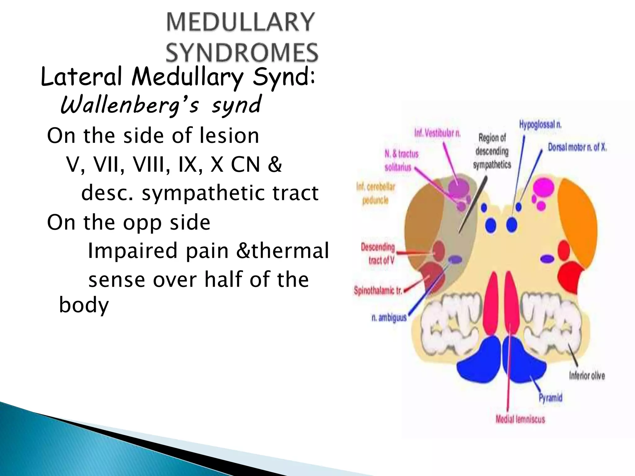 Brain stem syndromes | PPTX