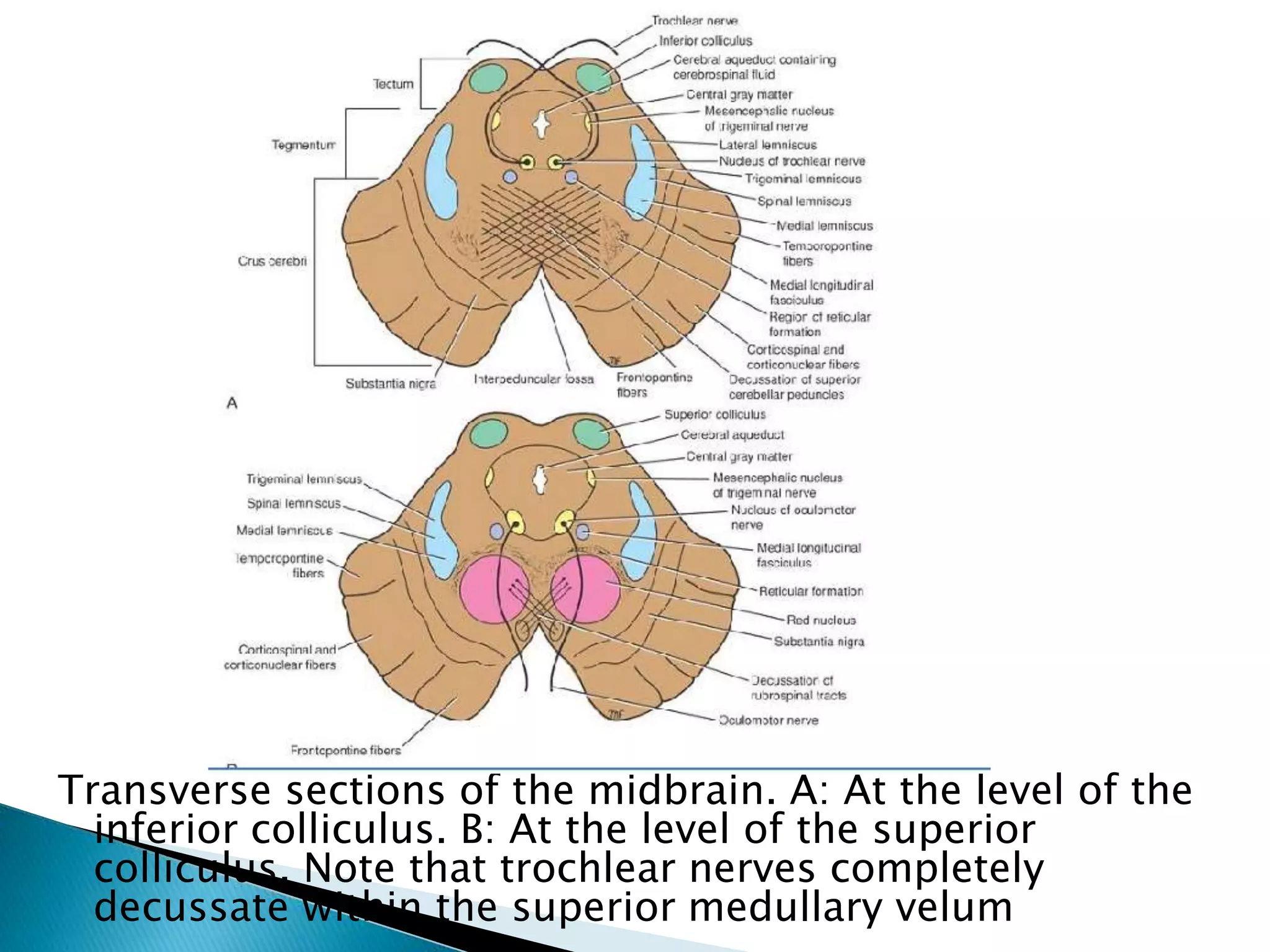 Brain stem syndromes | PPTX