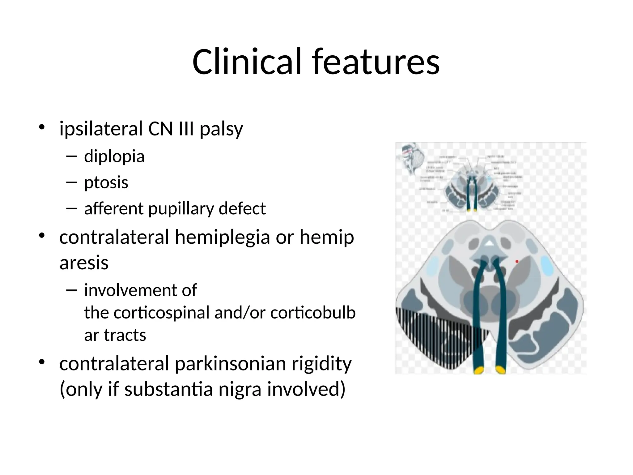 Brain stem syndromes POWER POINT PRESENTATION | PPTX