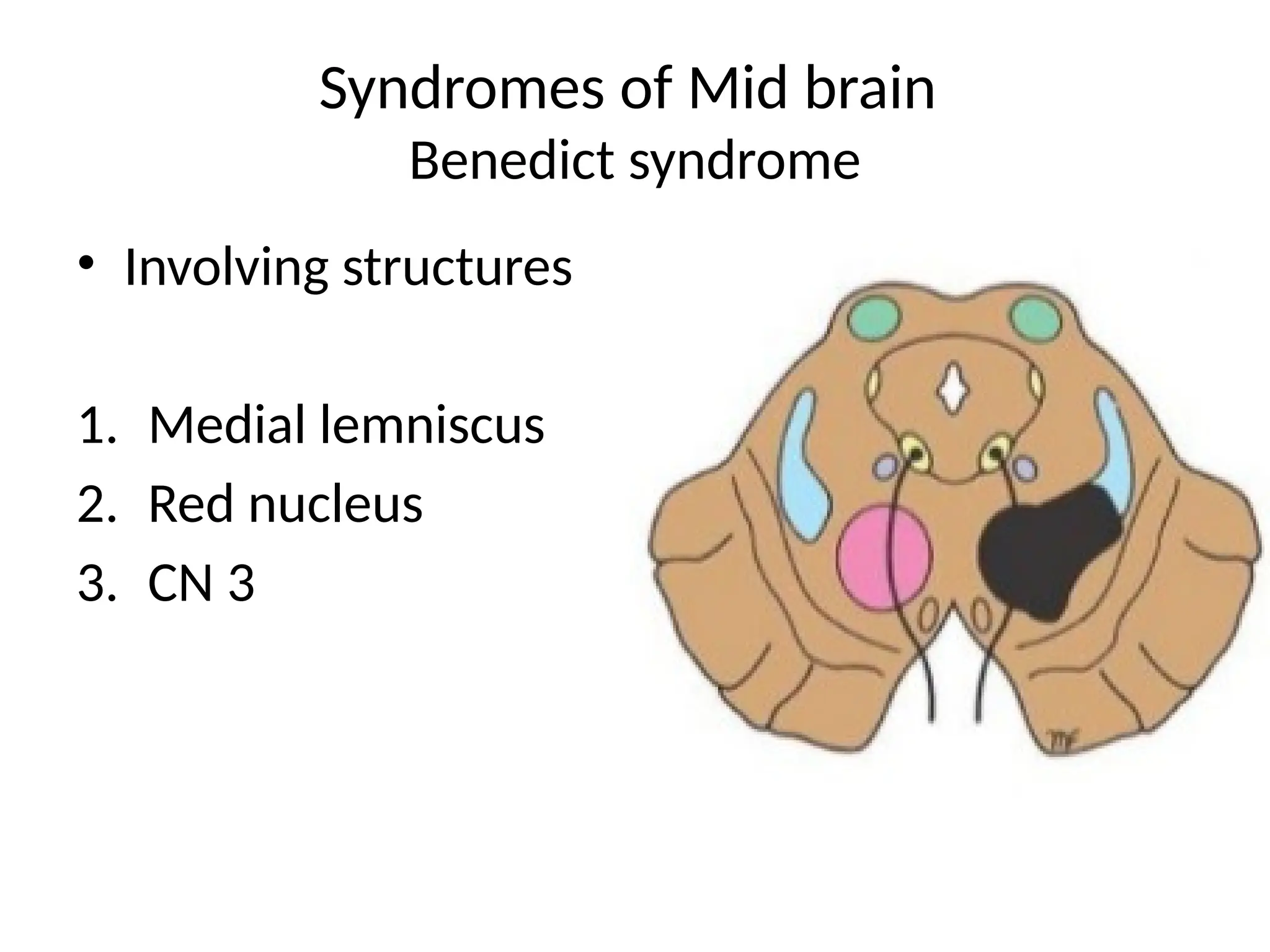 Brain stem syndromes POWER POINT PRESENTATION | PPTX
