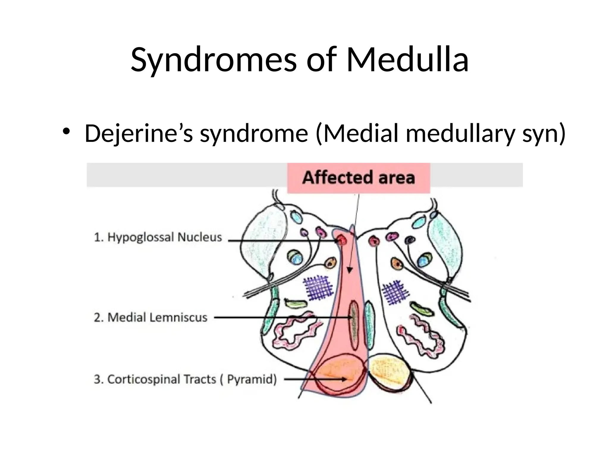 Brain stem syndromes POWER POINT PRESENTATION | PPTX