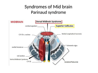 Brain stem syndromes POWER POINT PRESENTATION | PPTX