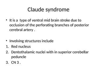 Brain stem syndromes POWER POINT PRESENTATION | PPTX
