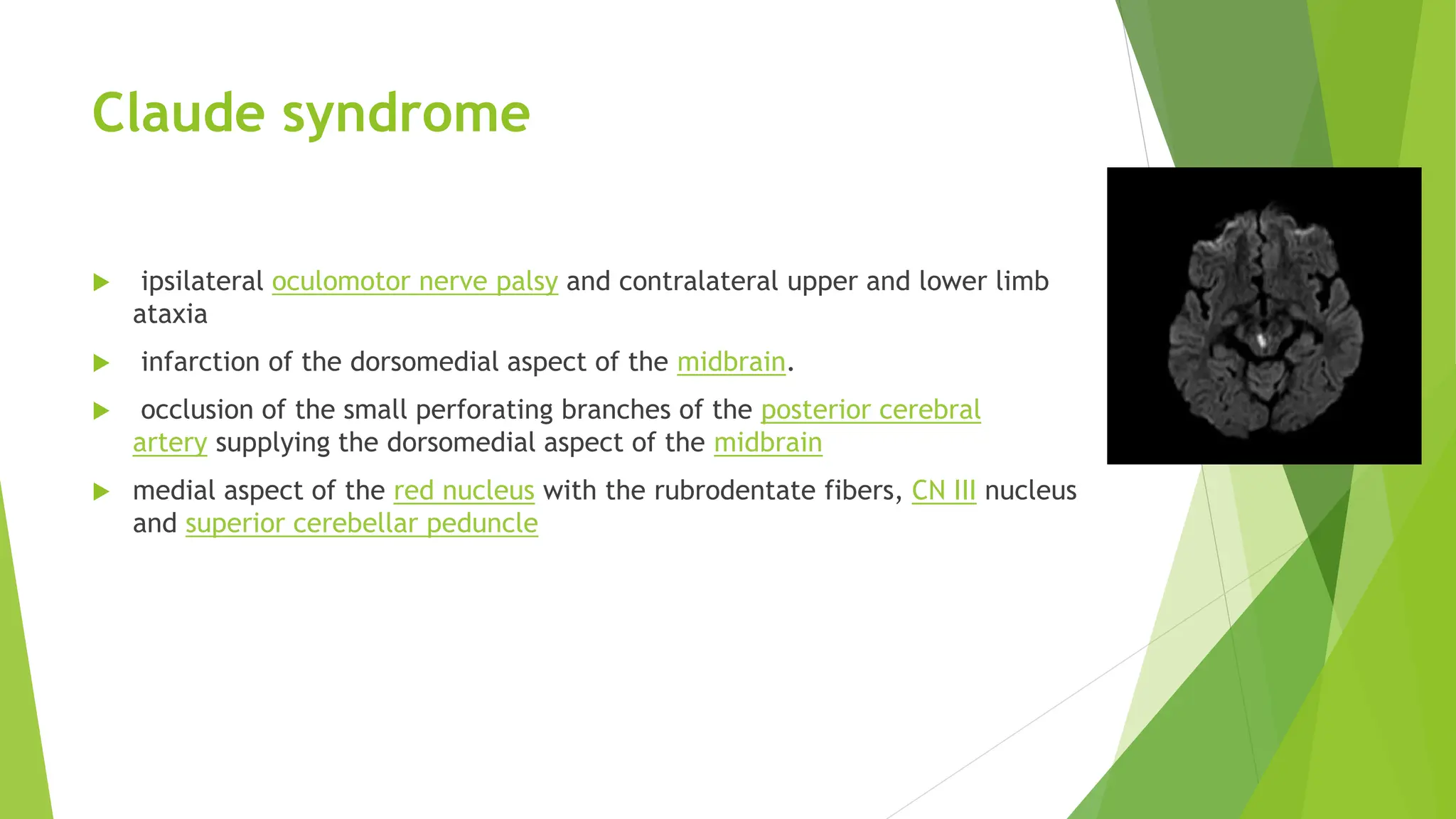 Brainstem Syndromes and multiple Cranial nerve palsies.pptx