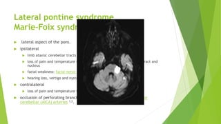 Brainstem Syndromes and multiple Cranial nerve palsies.pptx