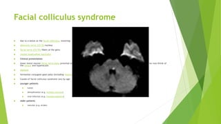 Brainstem Syndromes and multiple Cranial nerve palsies.pptx