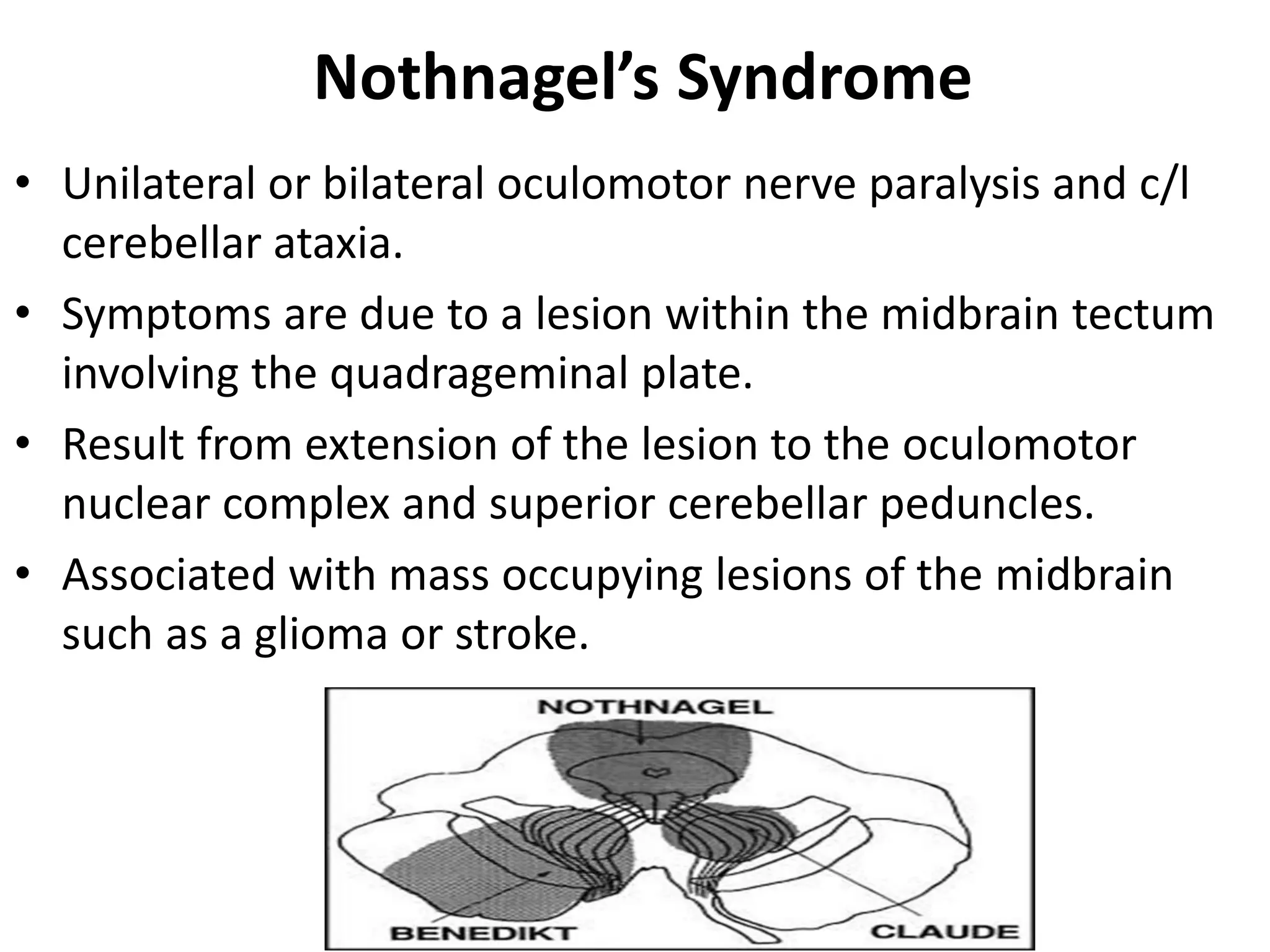 Brainstem syndrome vinod (1) | PPTX