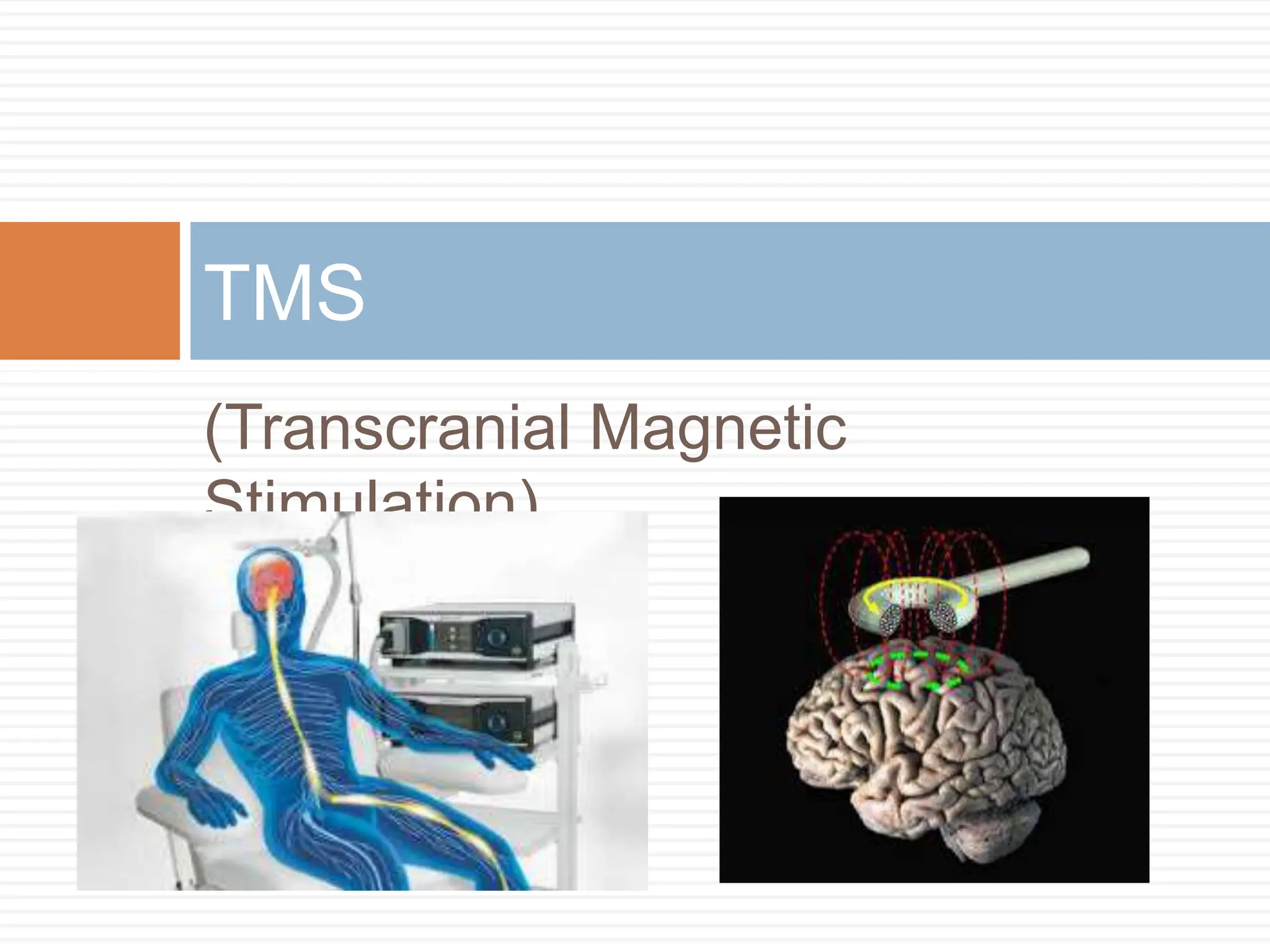 brain stimulation techniques (rTMS, tDCS, DBS) | PPTX