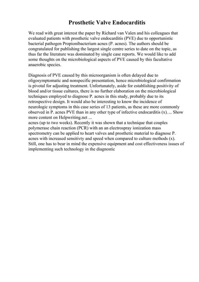 Brainstorming Techniques For Writing Essays.pdf