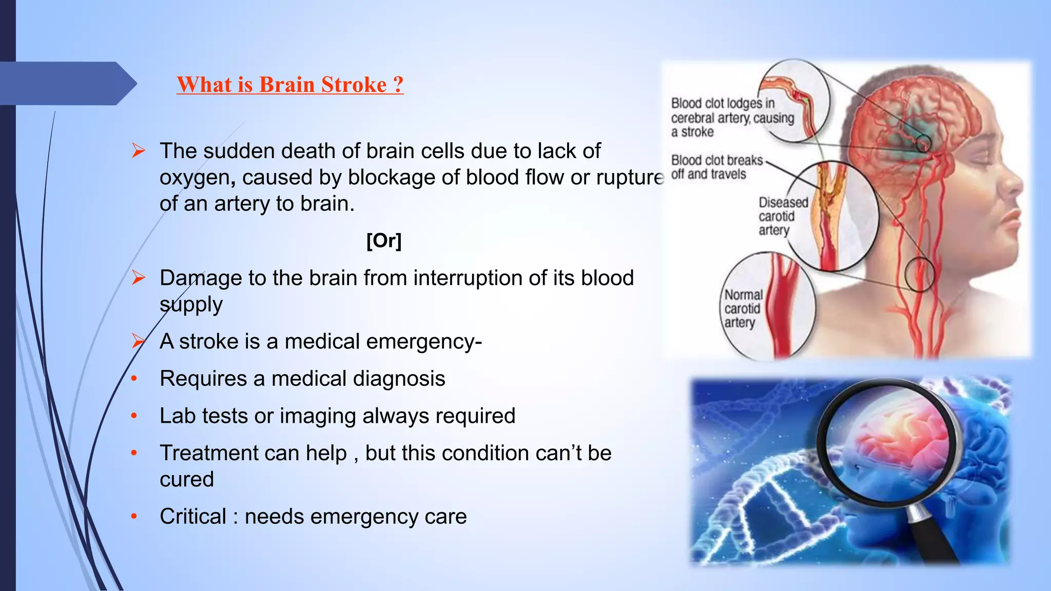 Brain Stroke PPT | PPTX