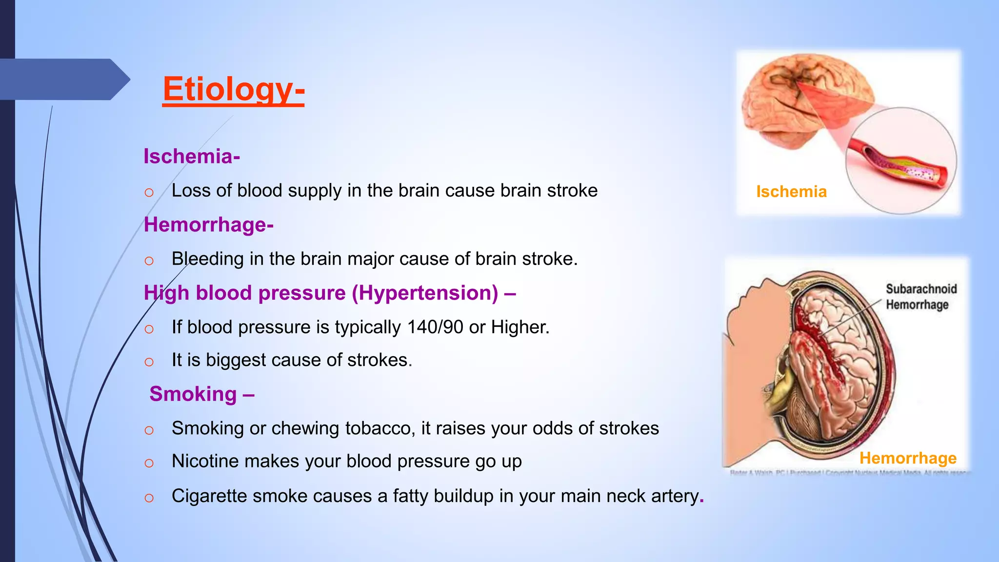 Brain Stroke PPT | PPTX