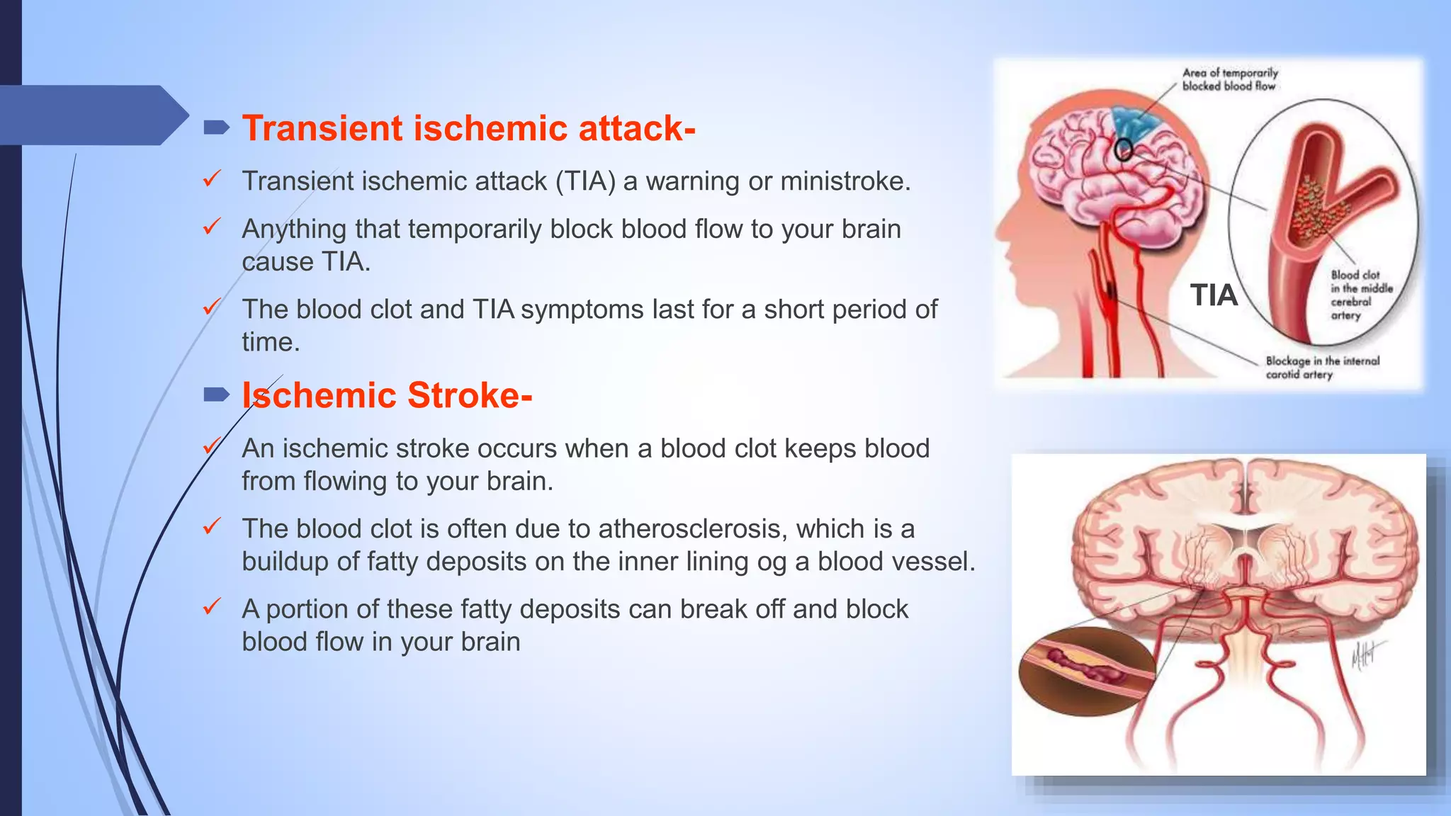 Brain Stroke PPT | PPTX
