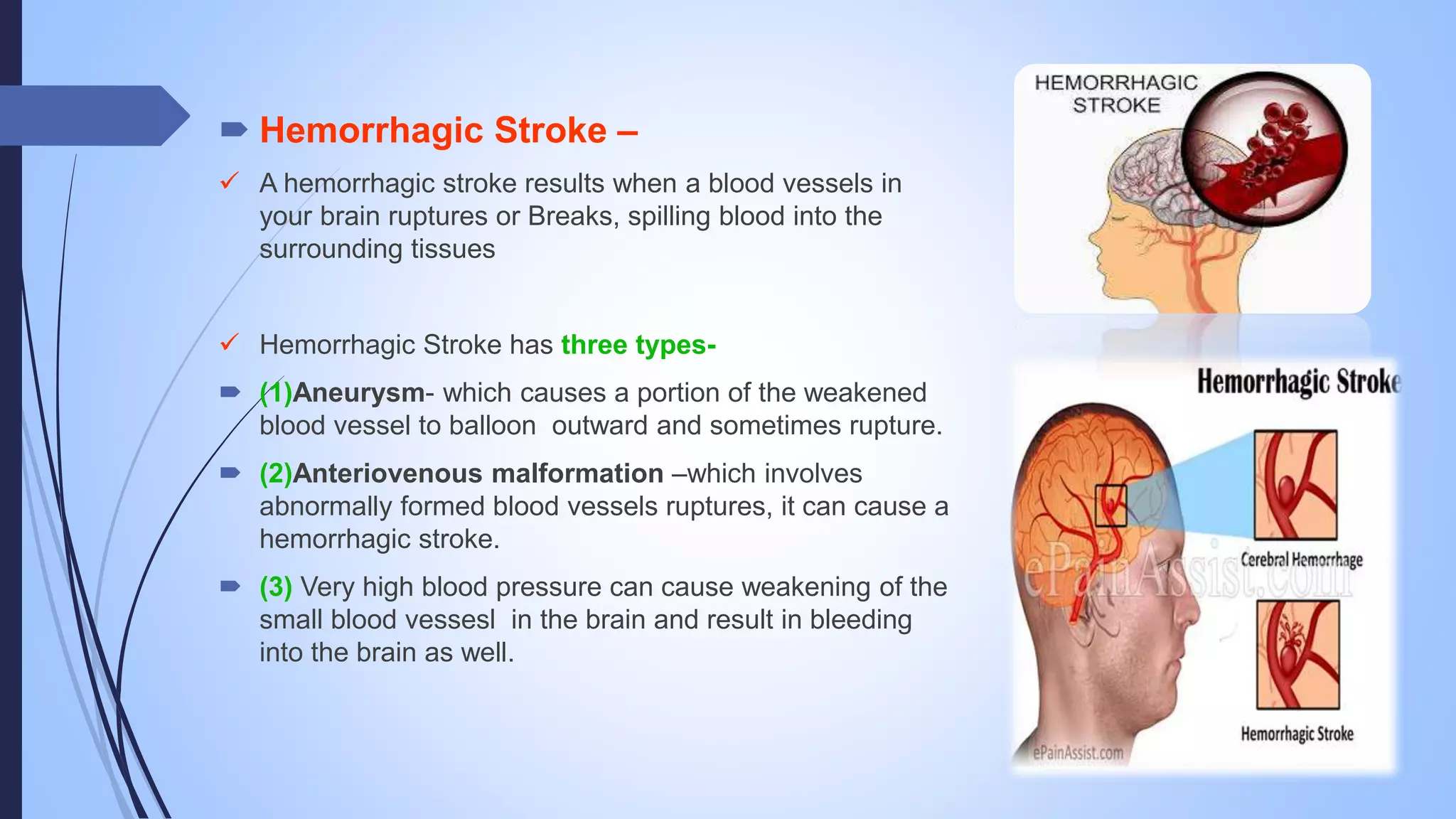 Brain Stroke PPT | PPTX