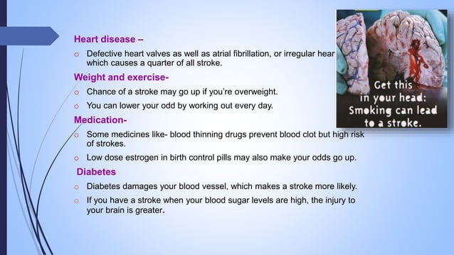 Brain Stroke PPT | PPTX | Brain and Nervous System Disorders | Diseases and Conditions