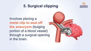 Brain stroke treatment | Yashoda Hospitals | PPTX