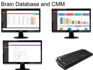 Brain summary | PPTX
