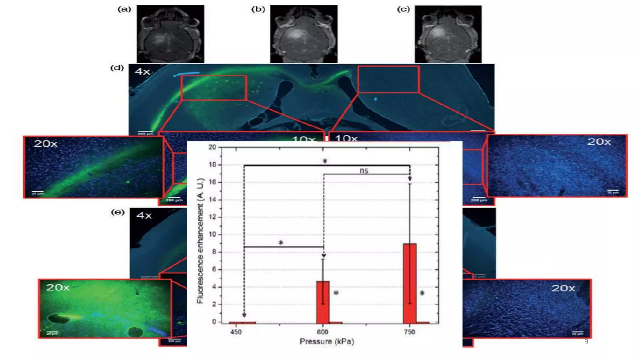 Lipid microbubbles as a vehicle for targeted drug delivery using ...