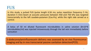 Lipid microbubbles as a vehicle for targeted drug delivery using ...