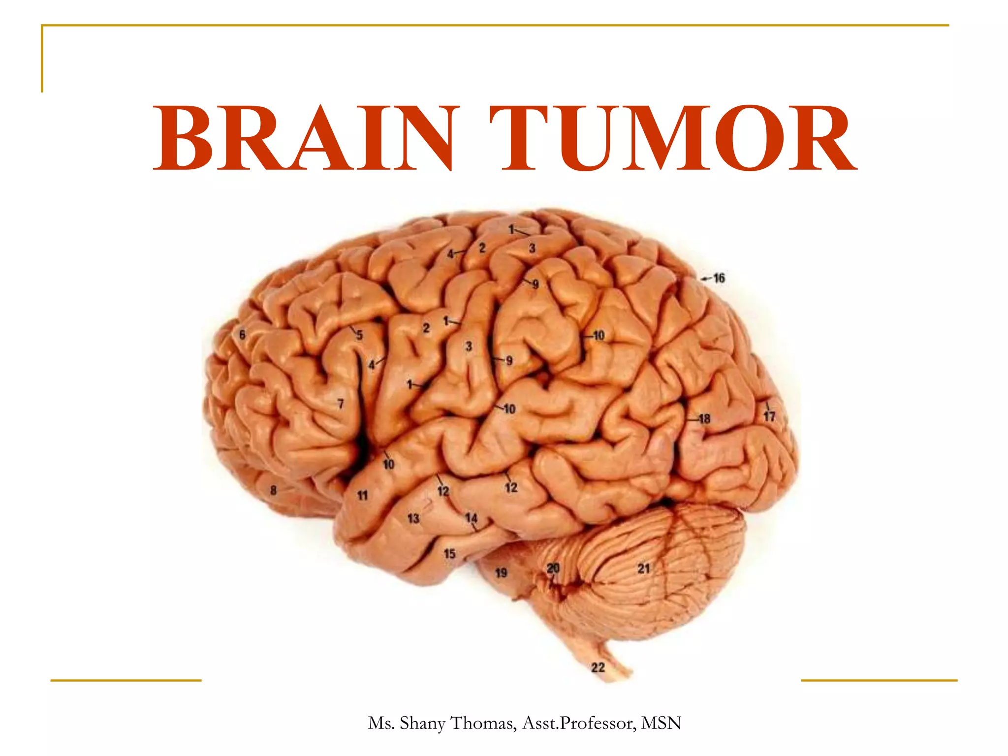 Brain tumor | PPT